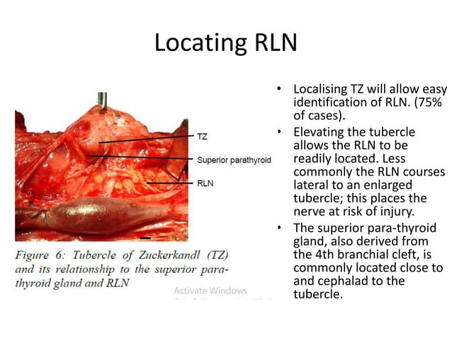thyroidectomy notes.pptx