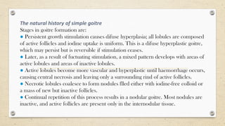 thyroid enlargment, goitre, including its types, causes, diagnosis ...