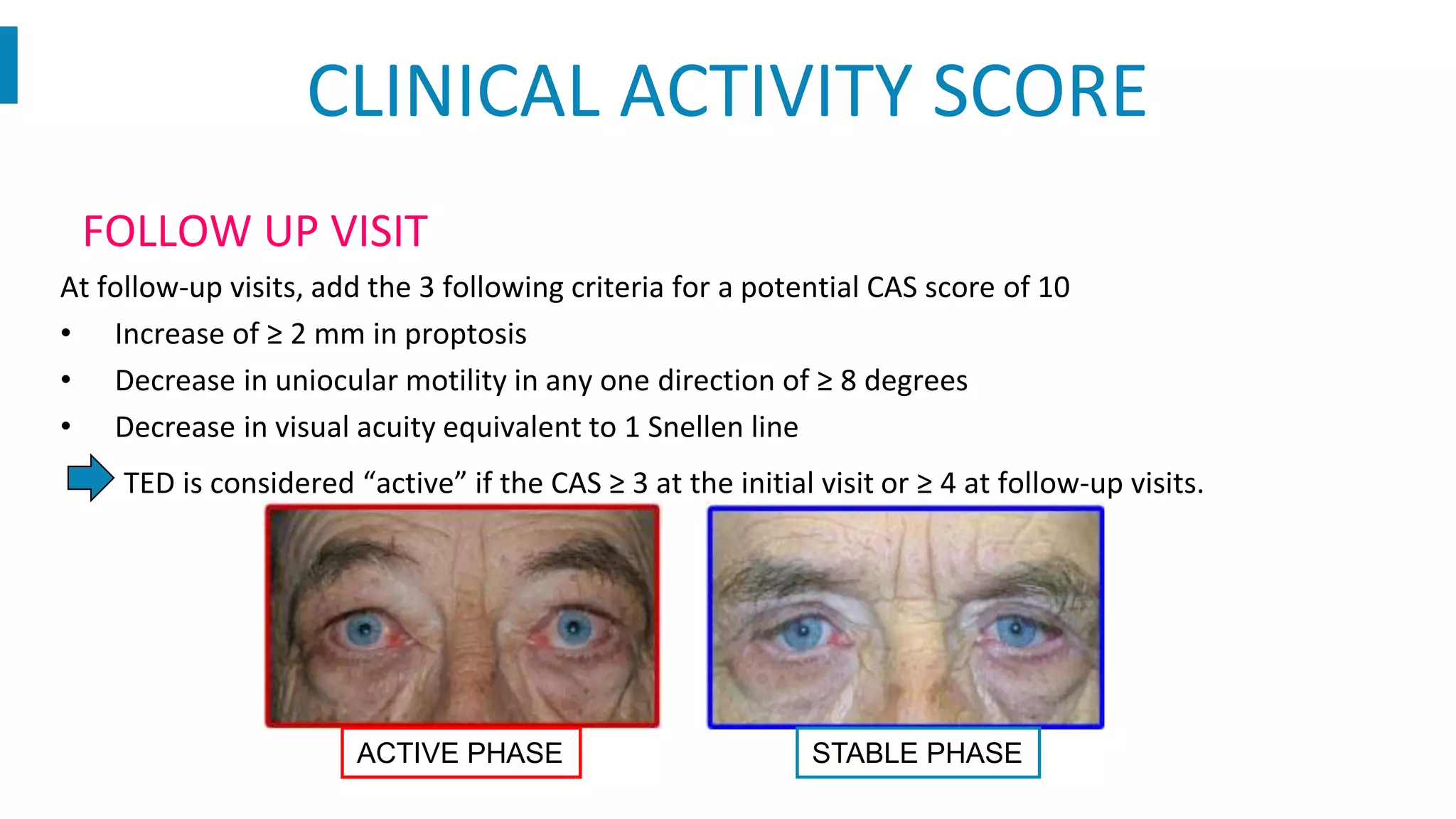 Thyroid eye disease evaluation and management | PPT