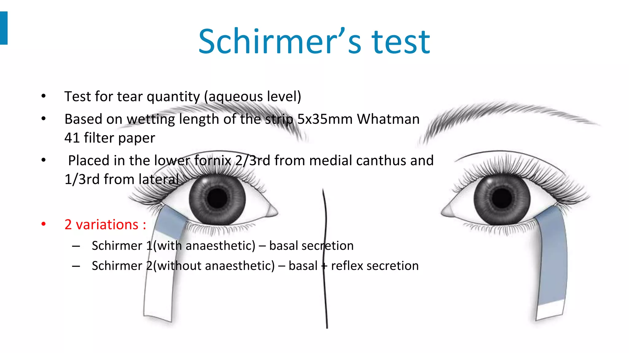 Thyroid eye disease evaluation and management | PPT