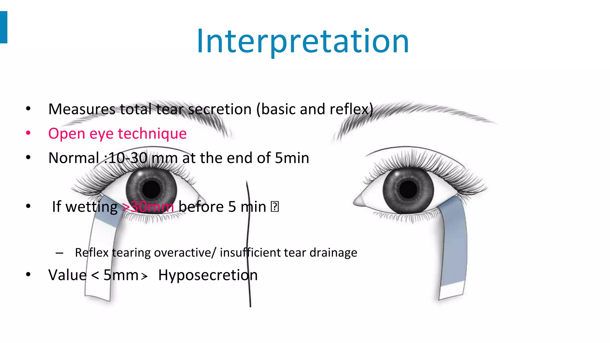 Thyroid eye disease evaluation and management | PPT