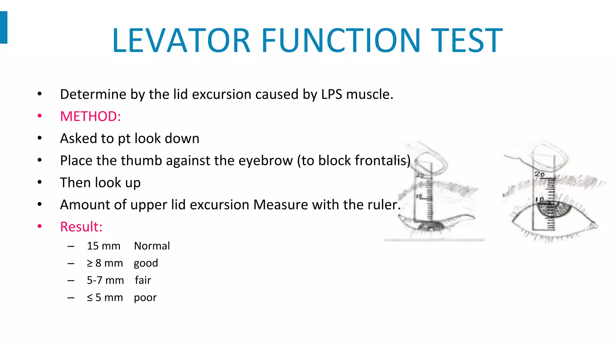 Thyroid eye disease evaluation and management | PPT