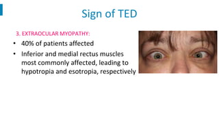 Thyroid eye disease evaluation and management | PPT