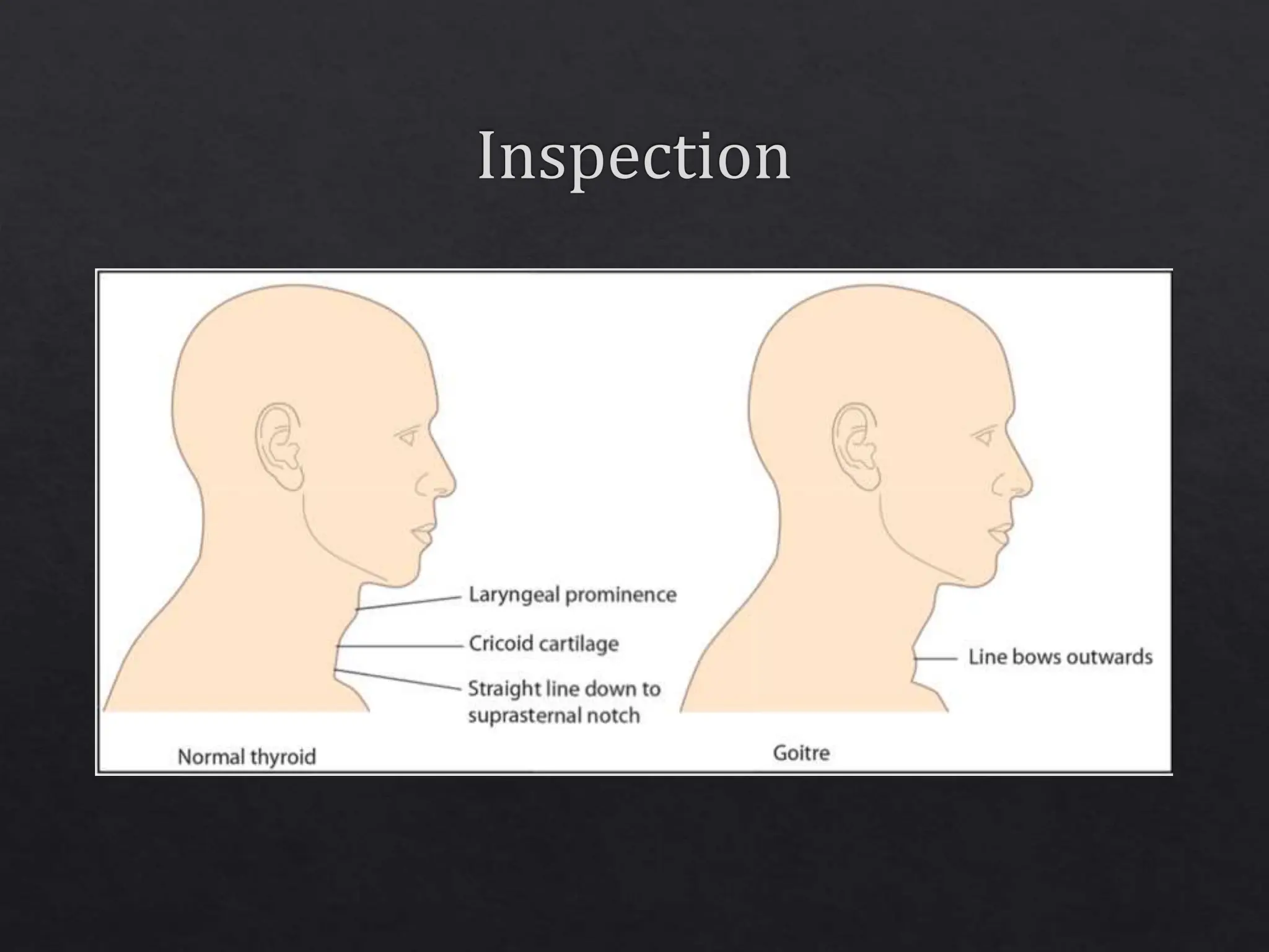 Thyroid Exam Copy Pptx