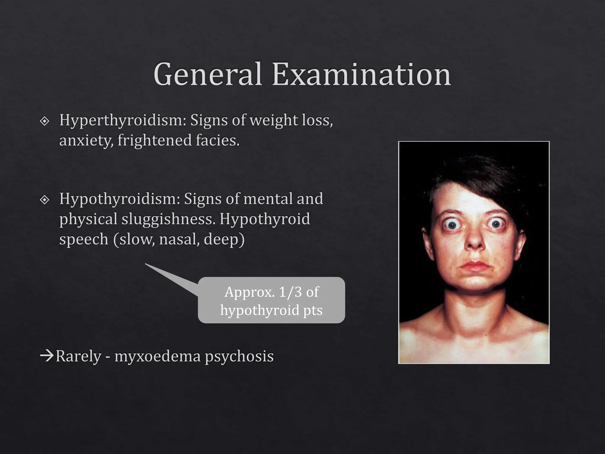 Thyroid Exam Copy Pptx