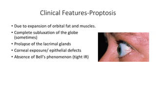 Thyroid eye disease ( Graves Ophthalmopathy ) | PPTX