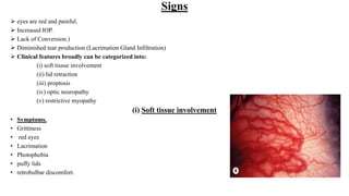 Thyroid eye disease.pptx