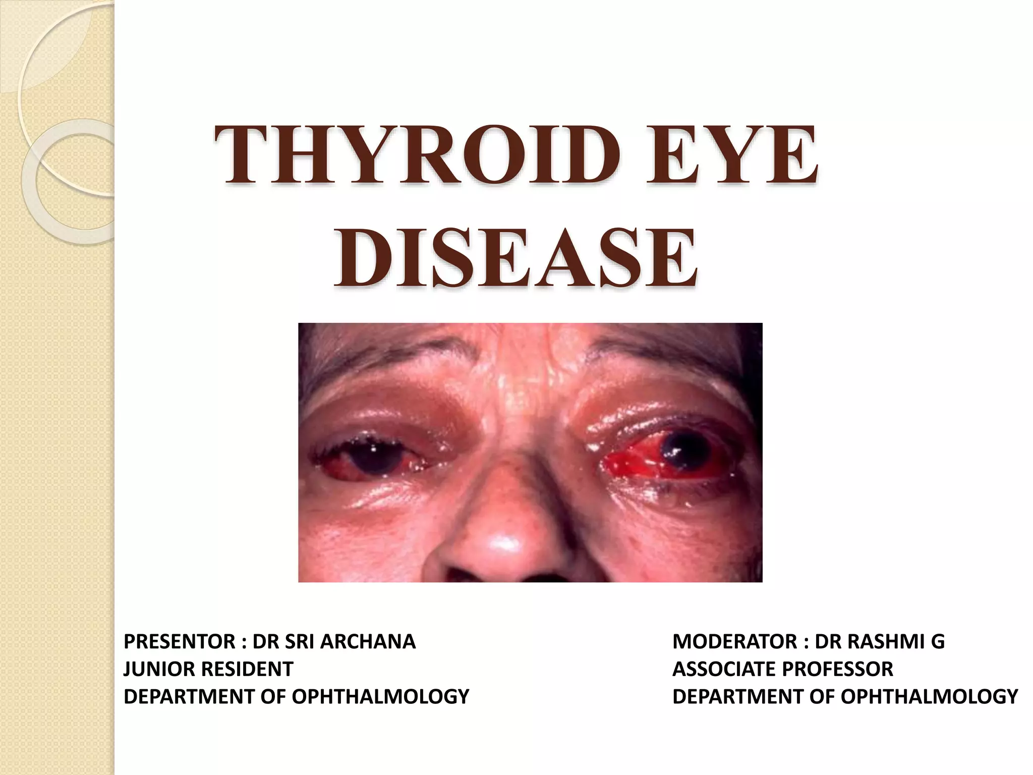 Thyroid eye disease | PPTX