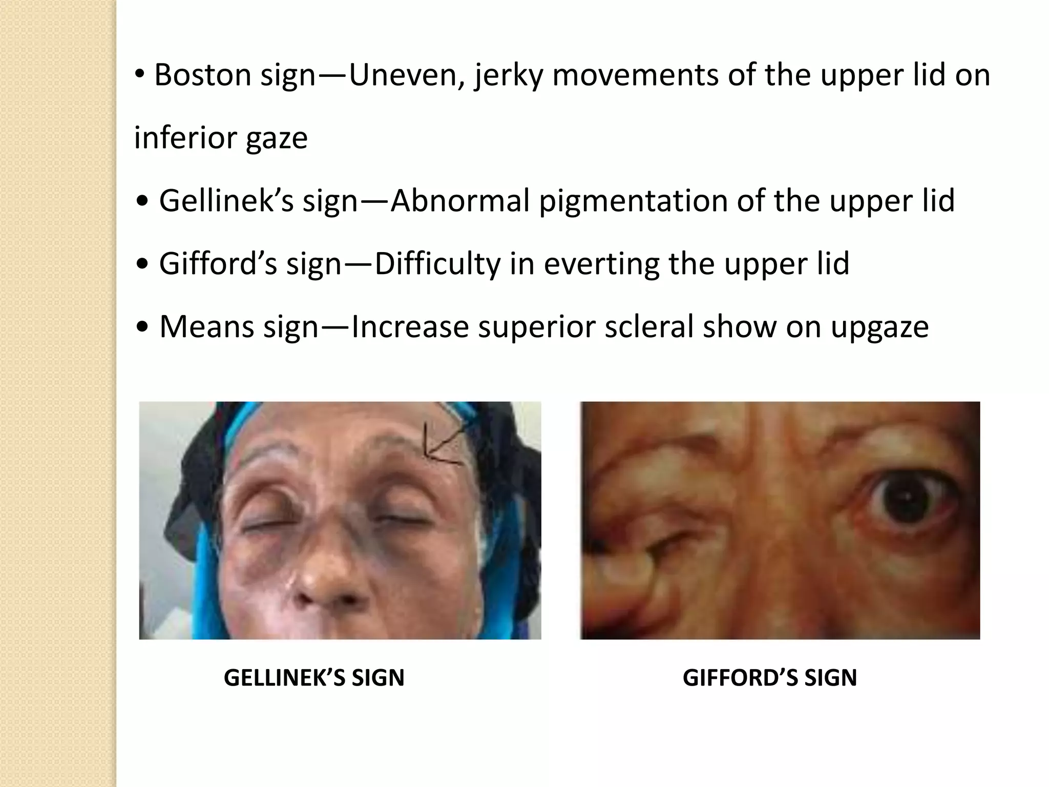 Thyroid eye disease | PPTX