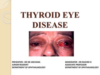 Gross Eye Diseases
