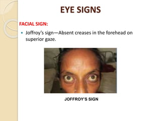 Thyroid eye disease | PPT
