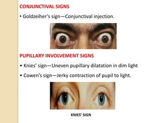 Thyroid eye disease | PPT