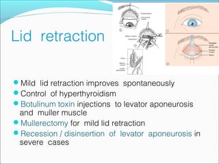 Thyroid eye disease presentation | PPT