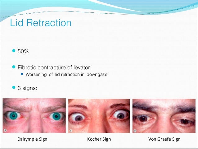 Thyroid eye disease presentation