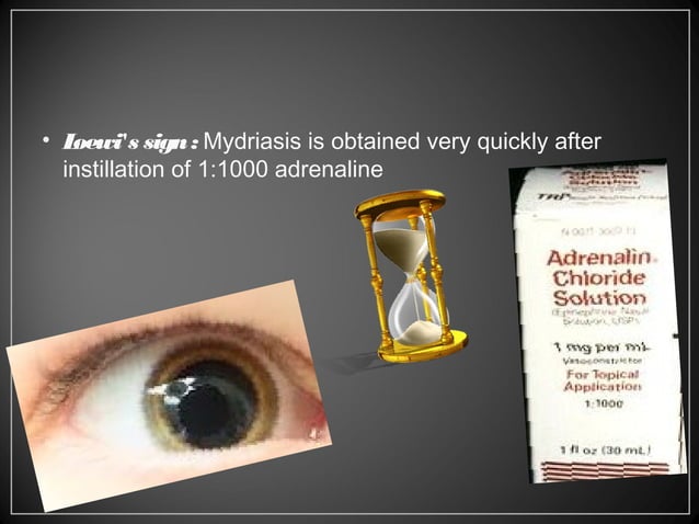 Thyroid eye diseases | PPT | Thyroid Disorders | Endocrine and ...