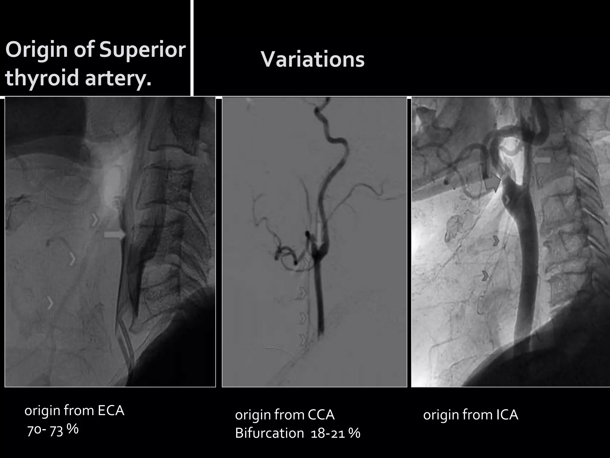 Thyroid, facial and lingual artery -- Anatomy and anastomosis | PPTX