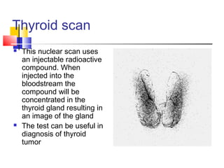 Thyroid final [part 1] | PPT
