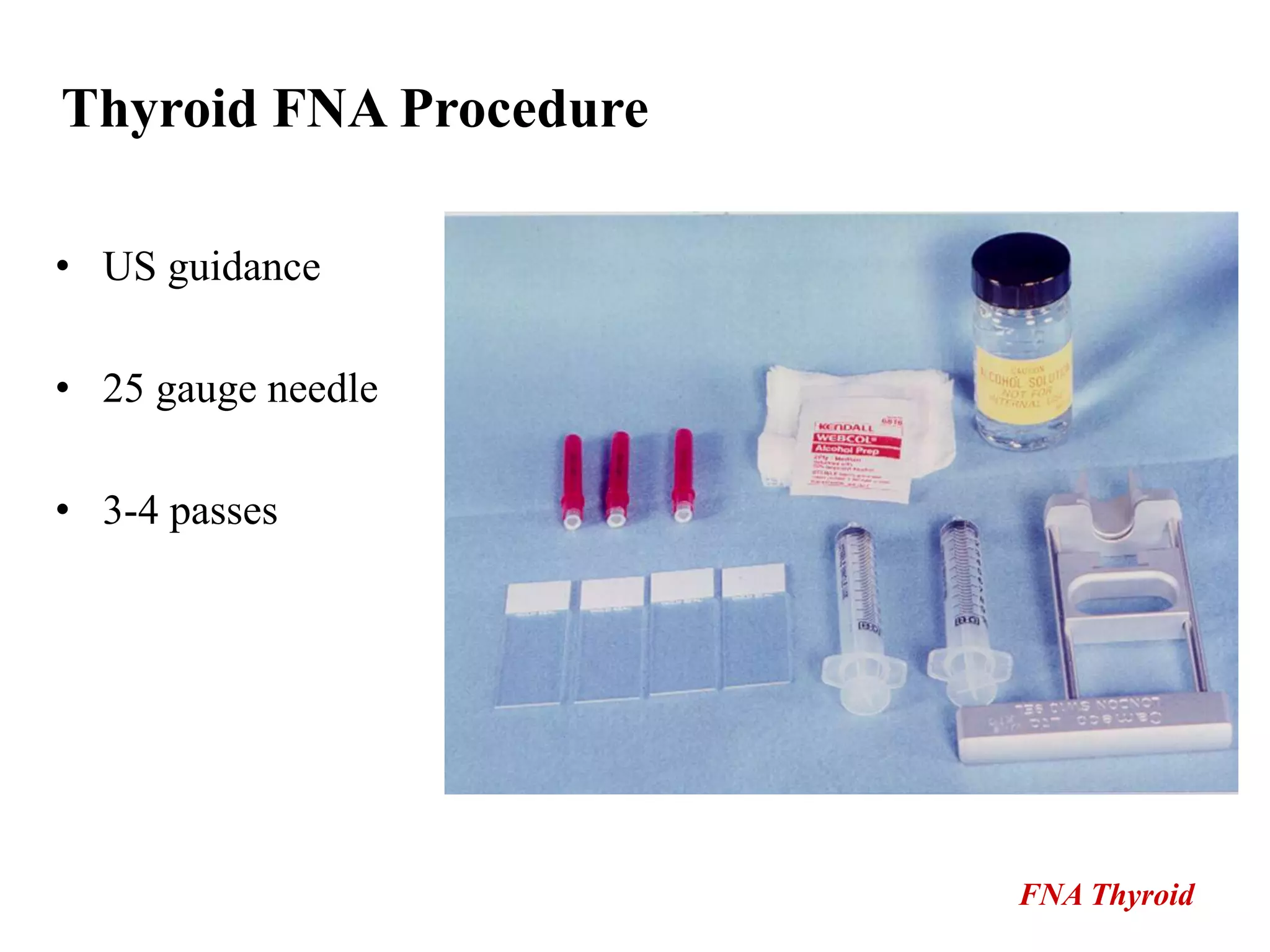 Thyroid Fna,bethesda system | PPTX