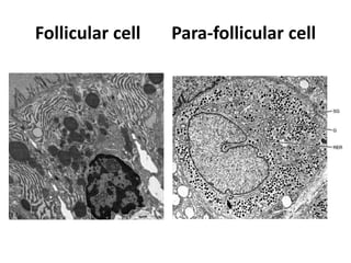 Follicular Cell Of Thyroid