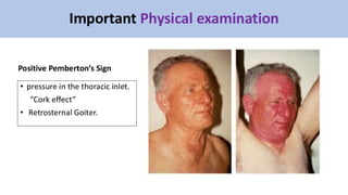 Thyroid for intern , basic approach to thyroid nodule | PDF