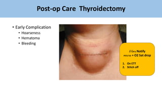 Thyroid for intern , basic approach to thyroid nodule | PDF