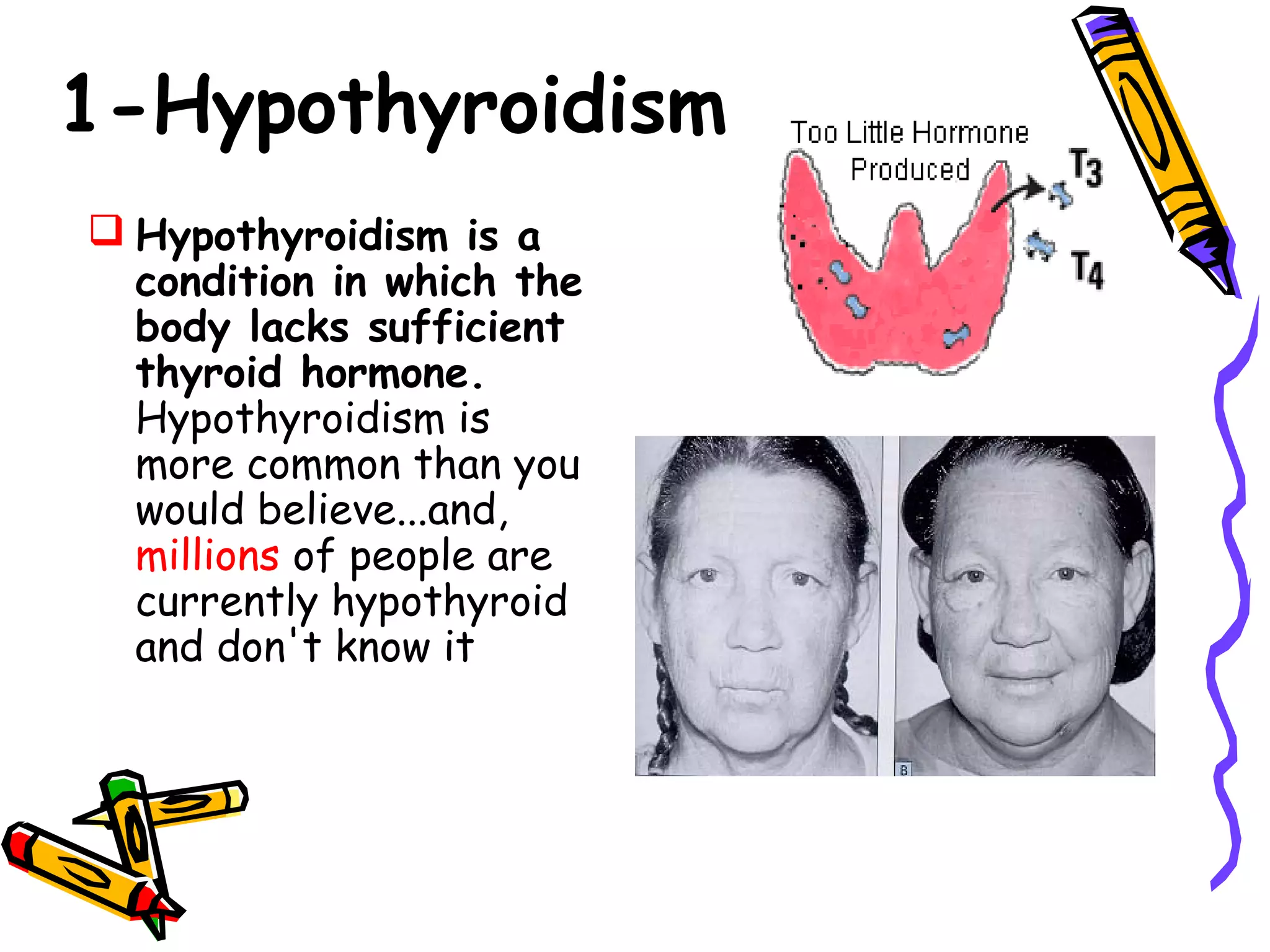 DIFFICULTIES IN LAB. DIAGNOSIS OF THYROID DISEASE | PPT