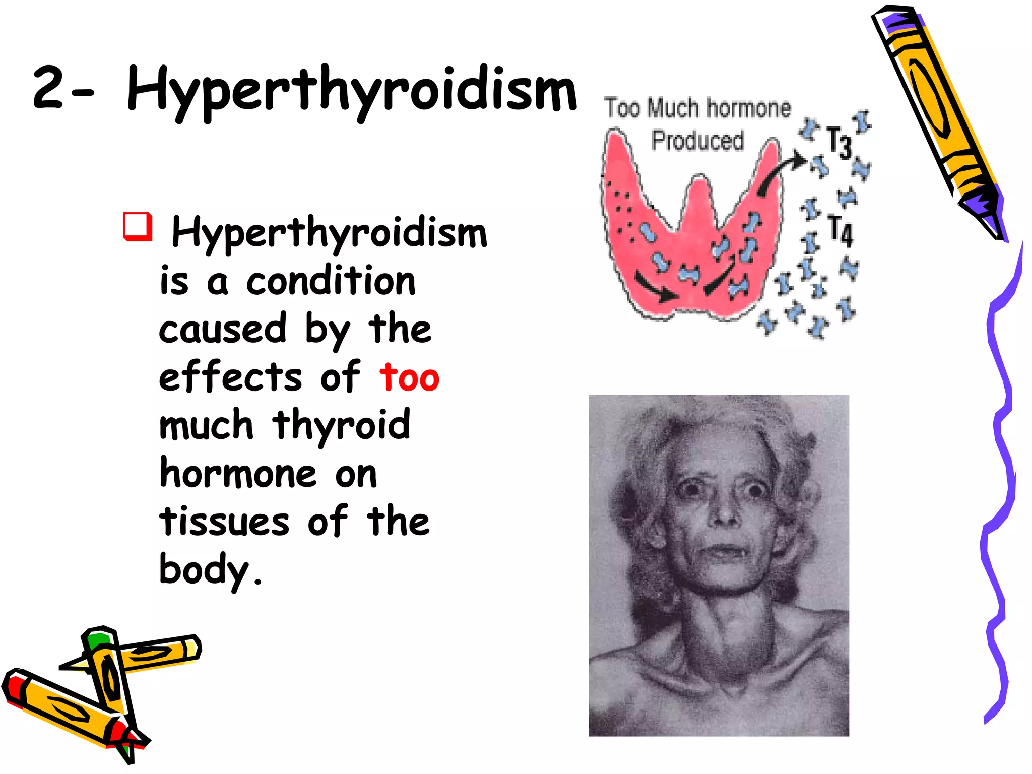 DIFFICULTIES IN LAB. DIAGNOSIS OF THYROID DISEASE | PPT