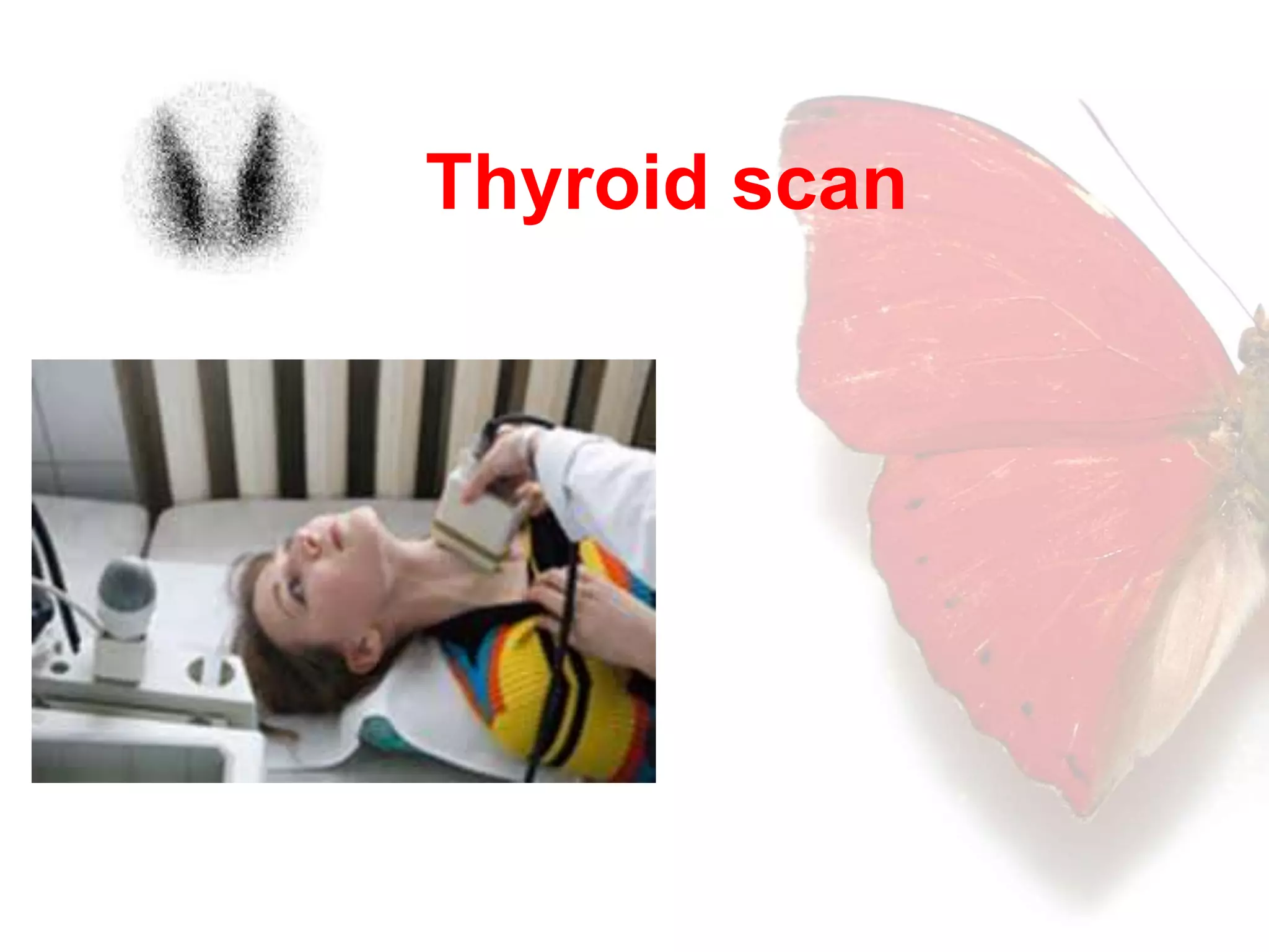 Thyroid Function Tests Pptx