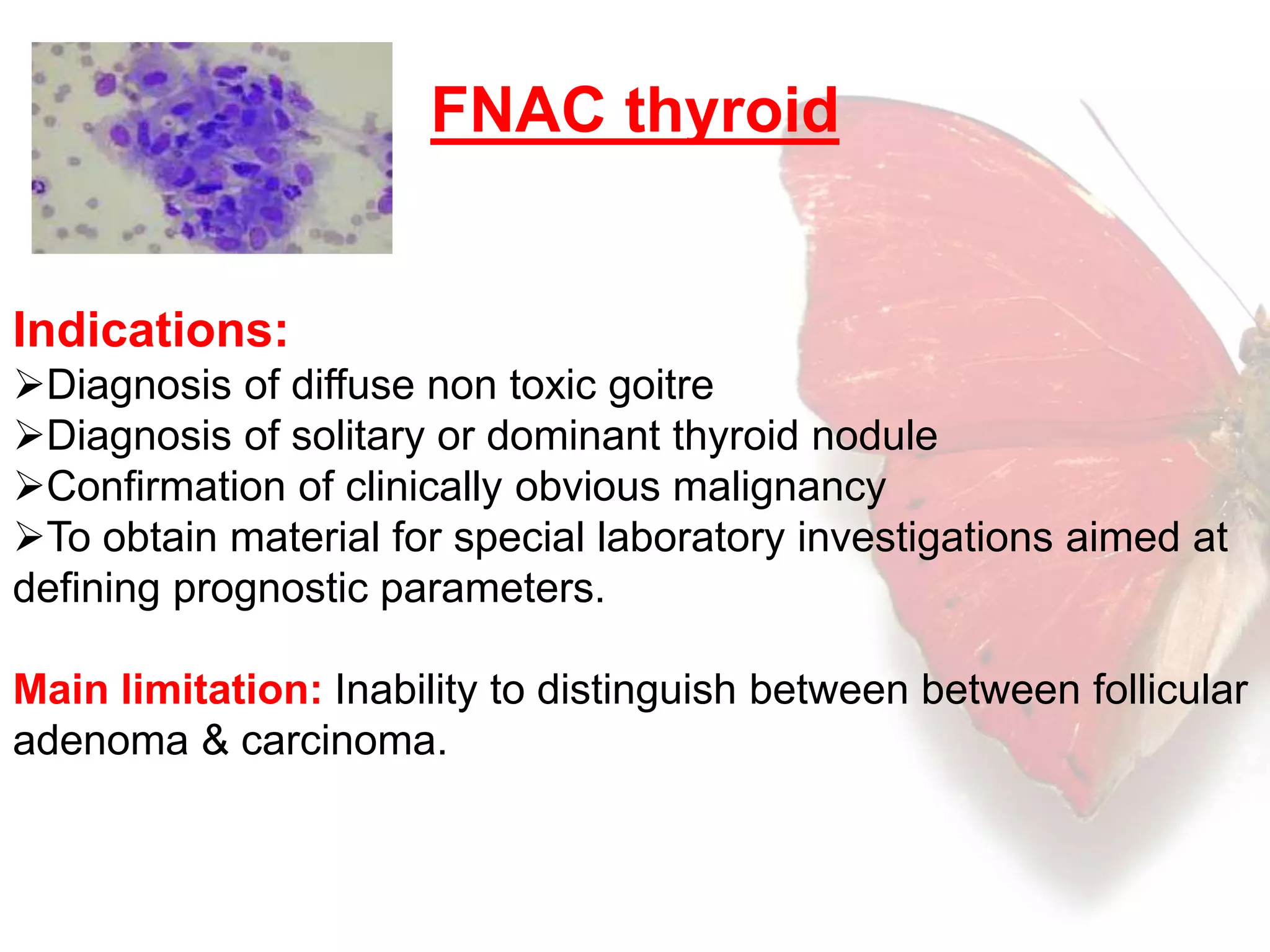 Thyroid function tests | PPTX