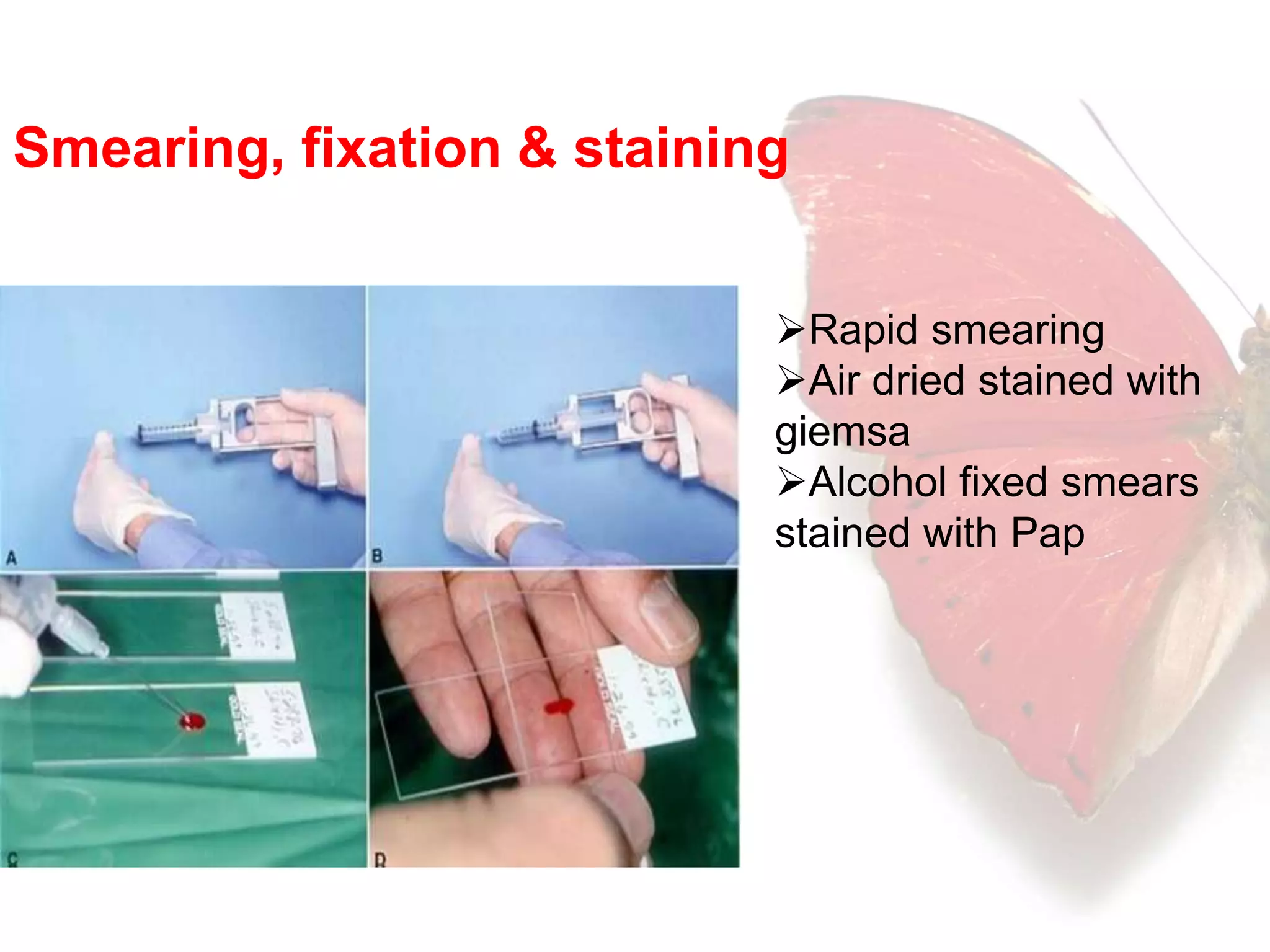 Thyroid function tests | PPTX