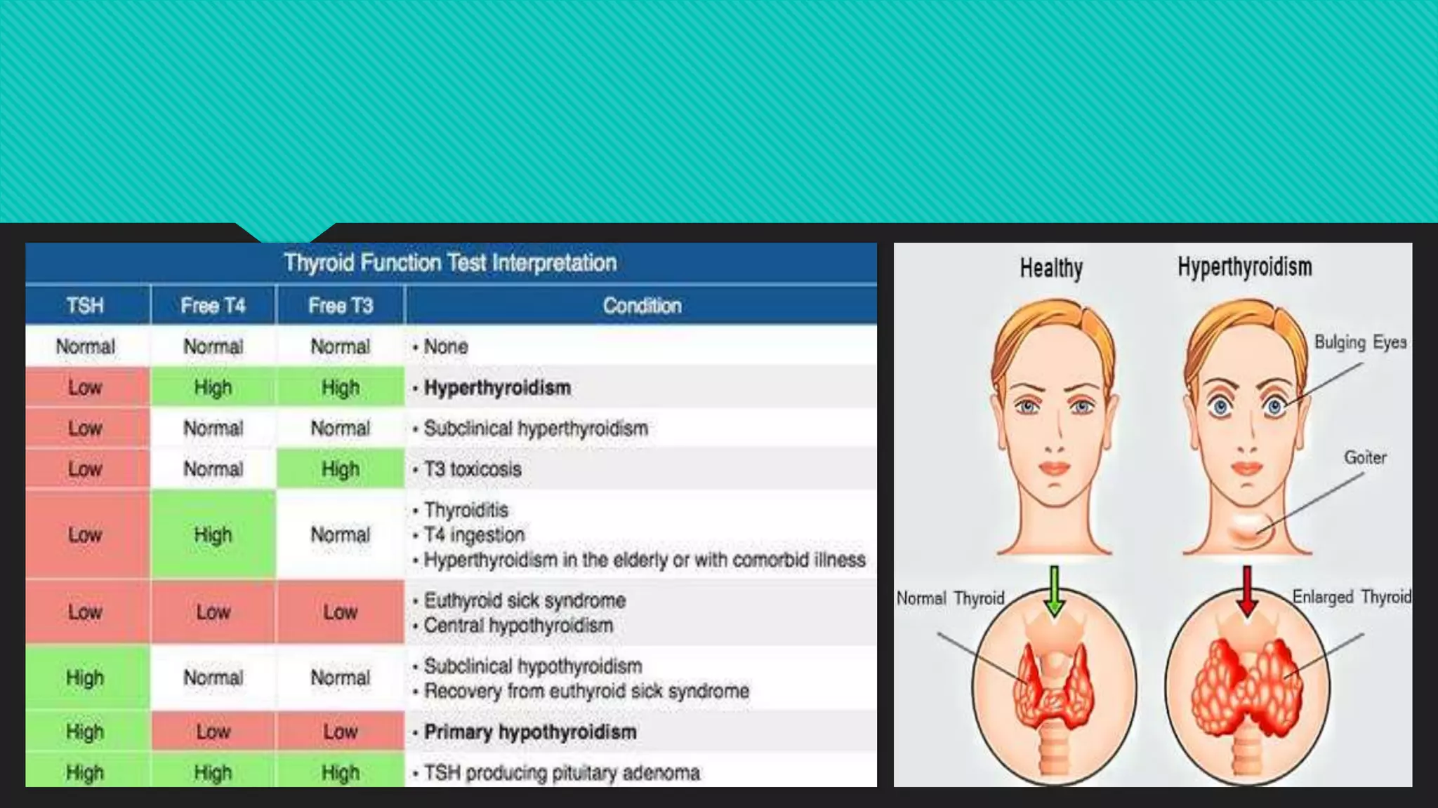 Thyroid function tests | PPTX
