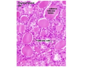 Thyroid Gland Slide Labeled