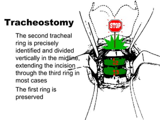 anatomy of Thyroid gland | PPT