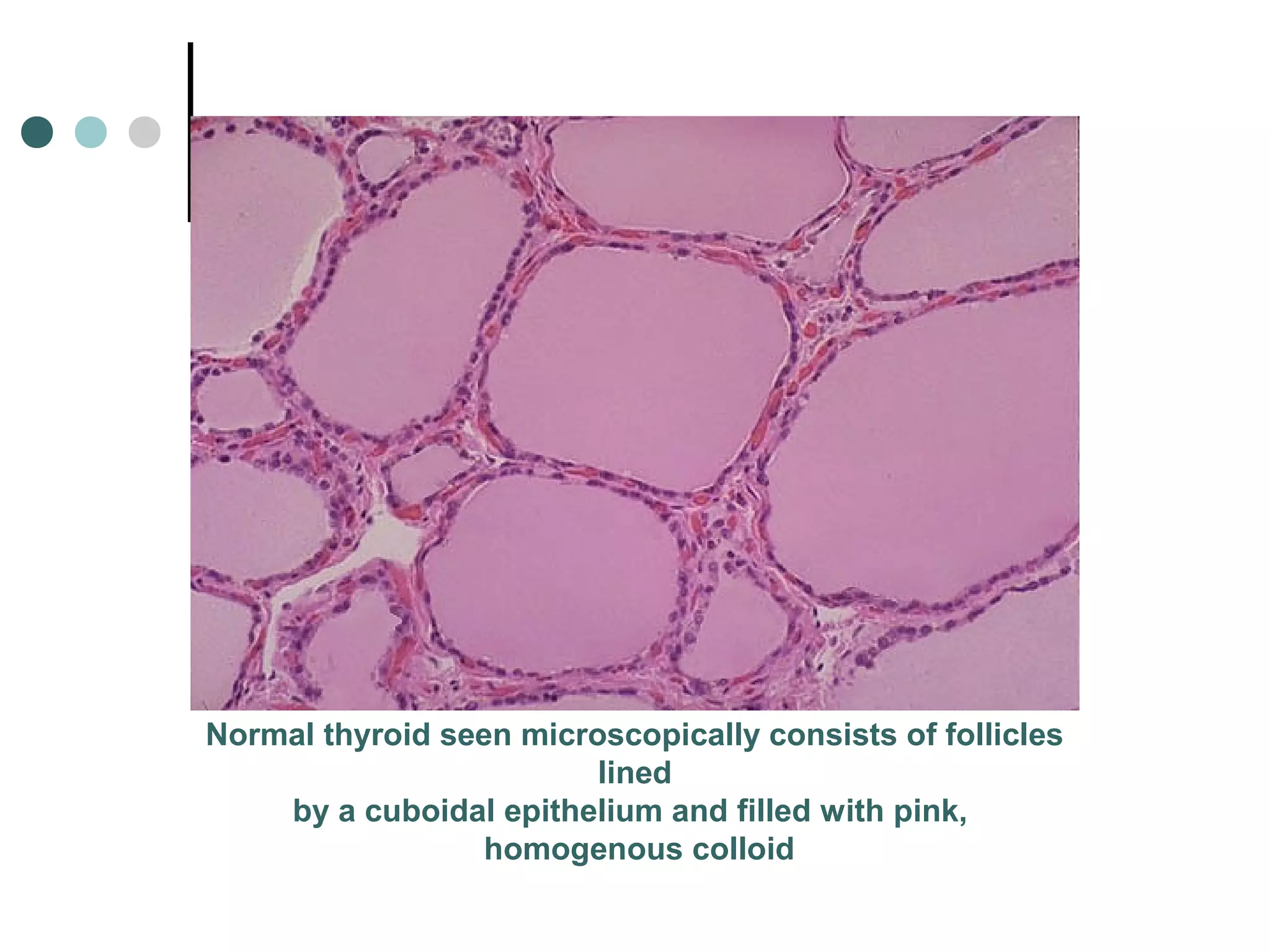 Thyroid gland anatomy, diseases , history and treatment | PPT