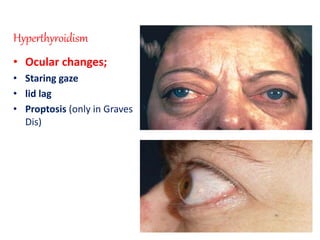 Thyroid gland dr faeza | PPTX