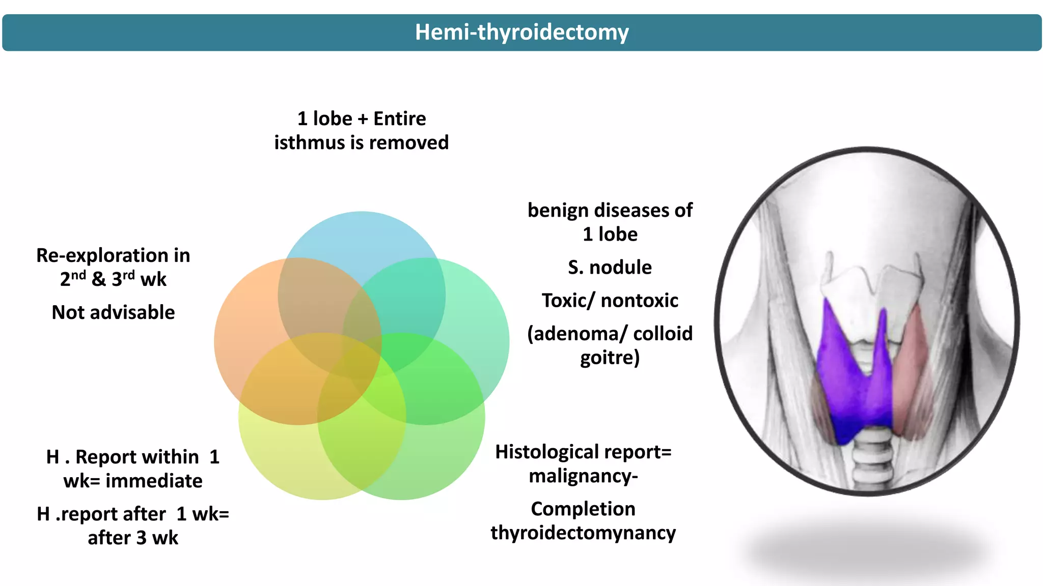 Thyroidectomy | PPTX
