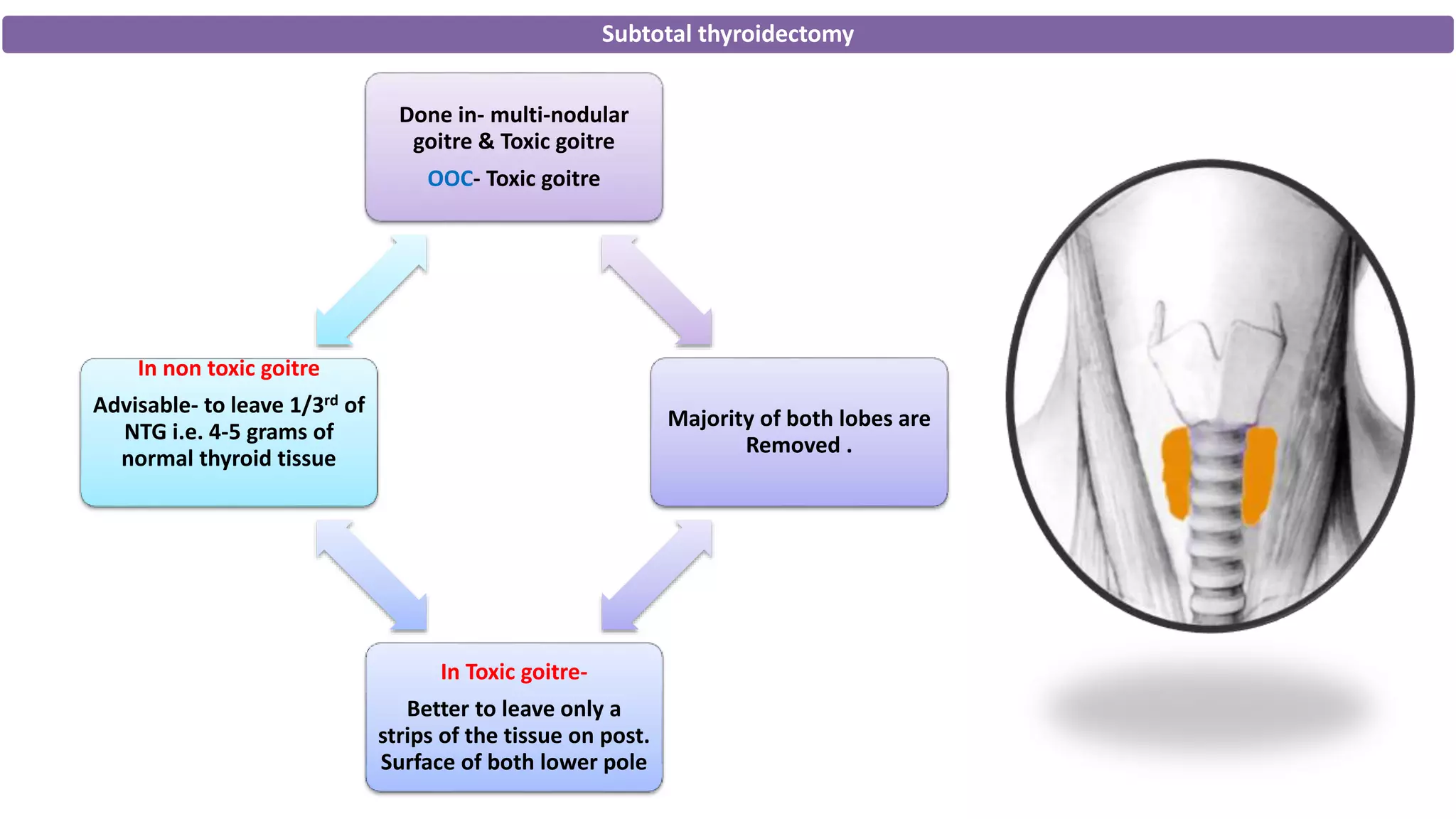 Thyroidectomy | PPTX