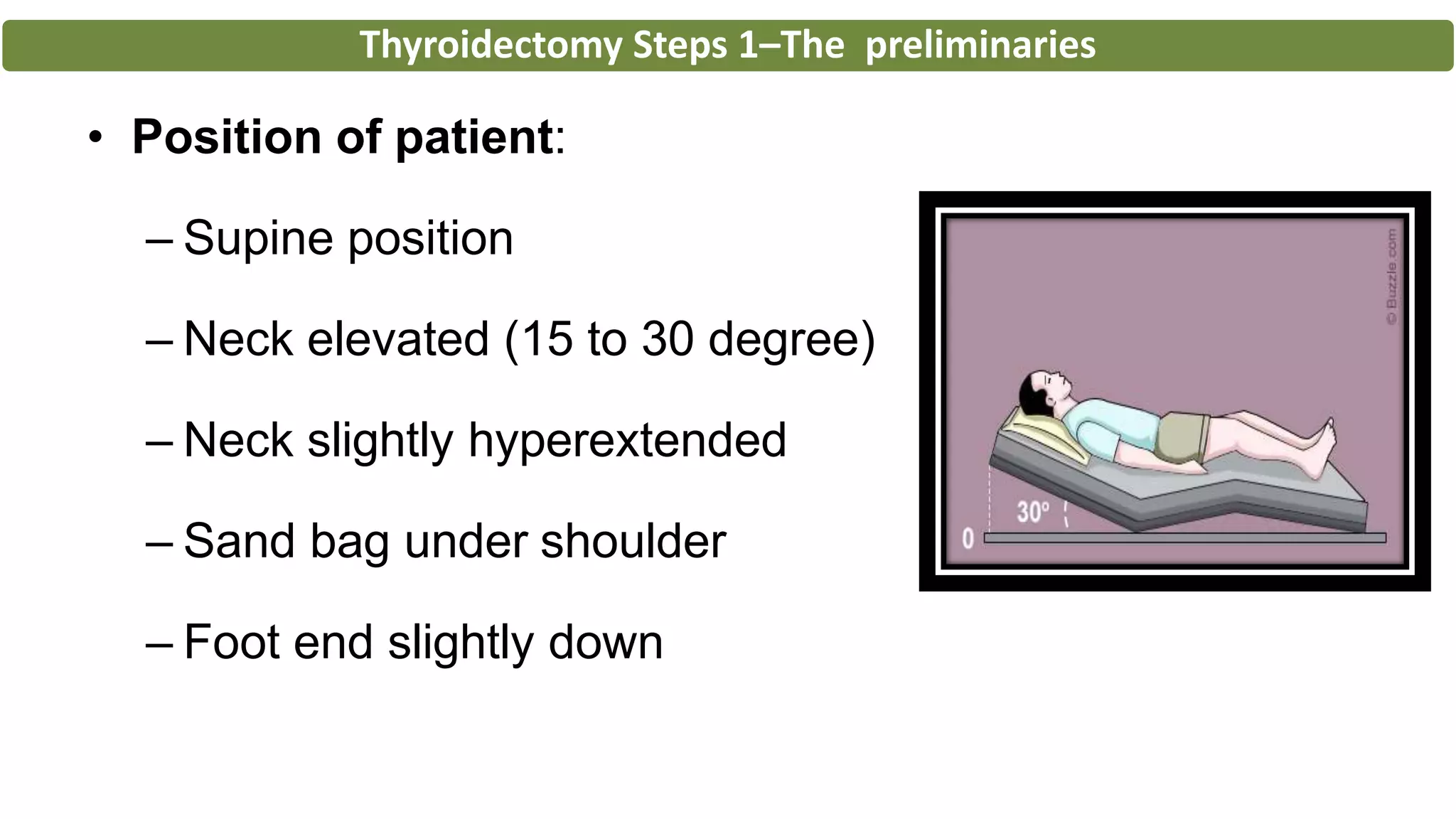 Thyroidectomy | PPTX