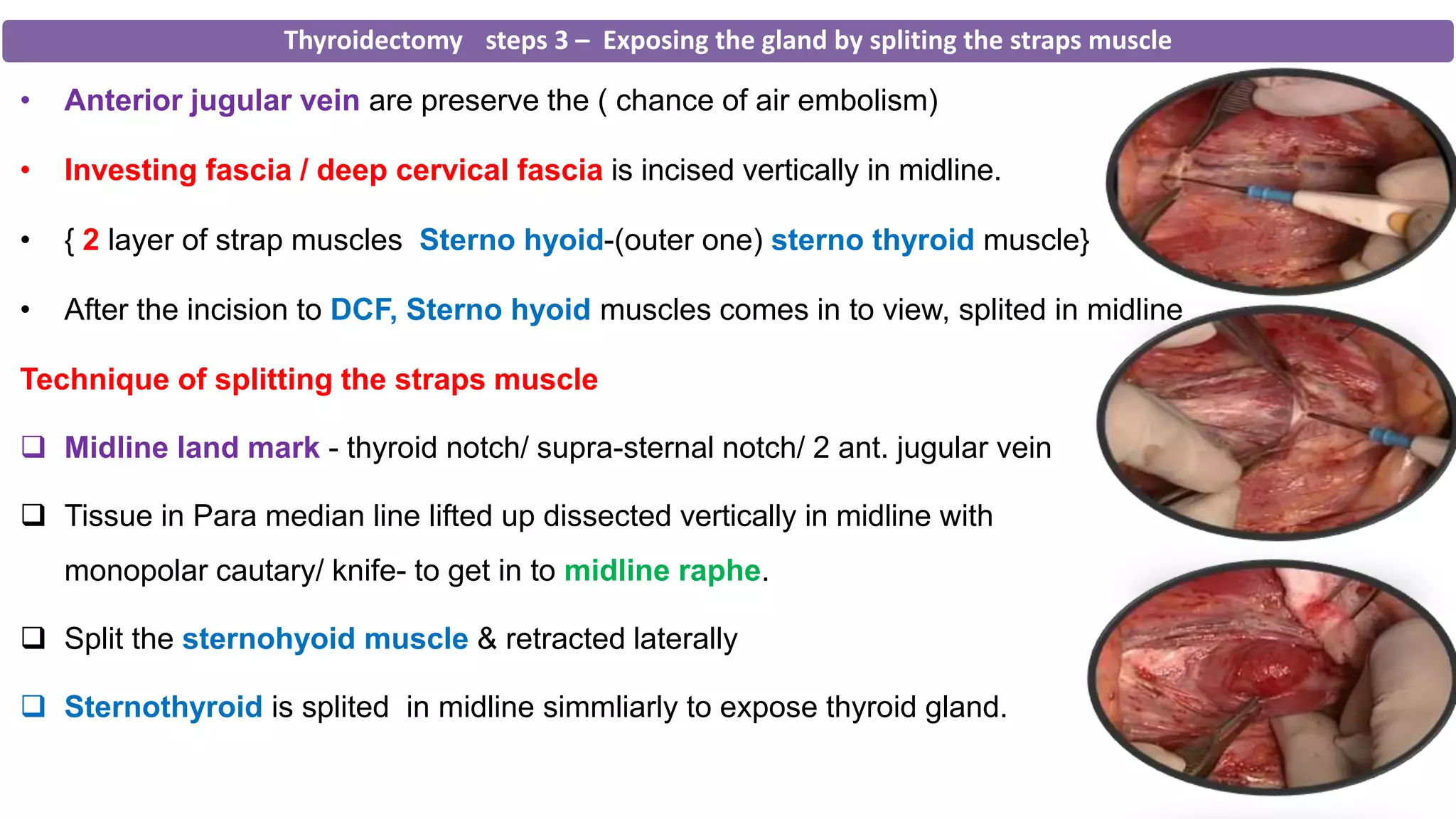 Thyroidectomy | PPTX