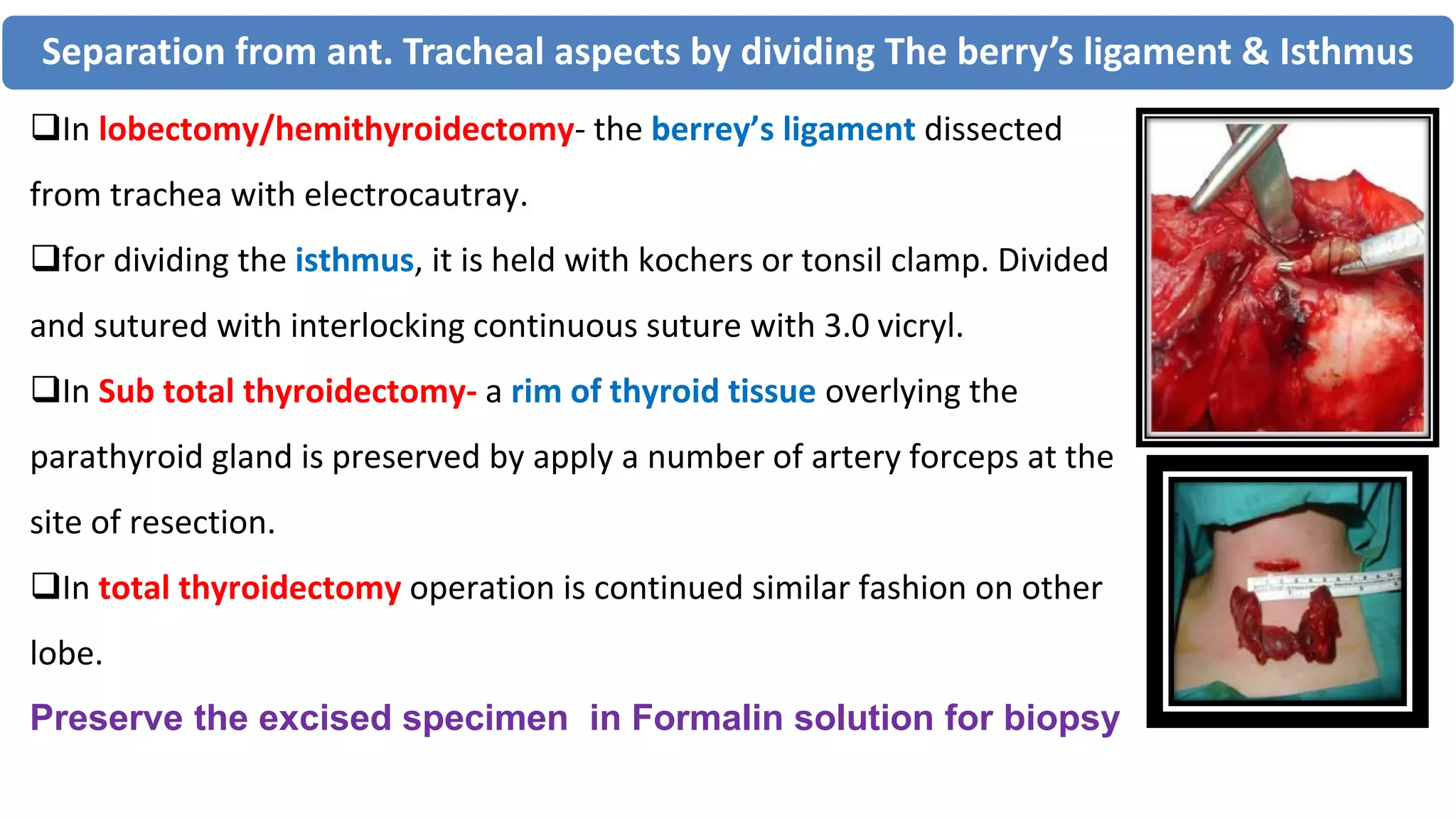 Thyroidectomy | PPTX