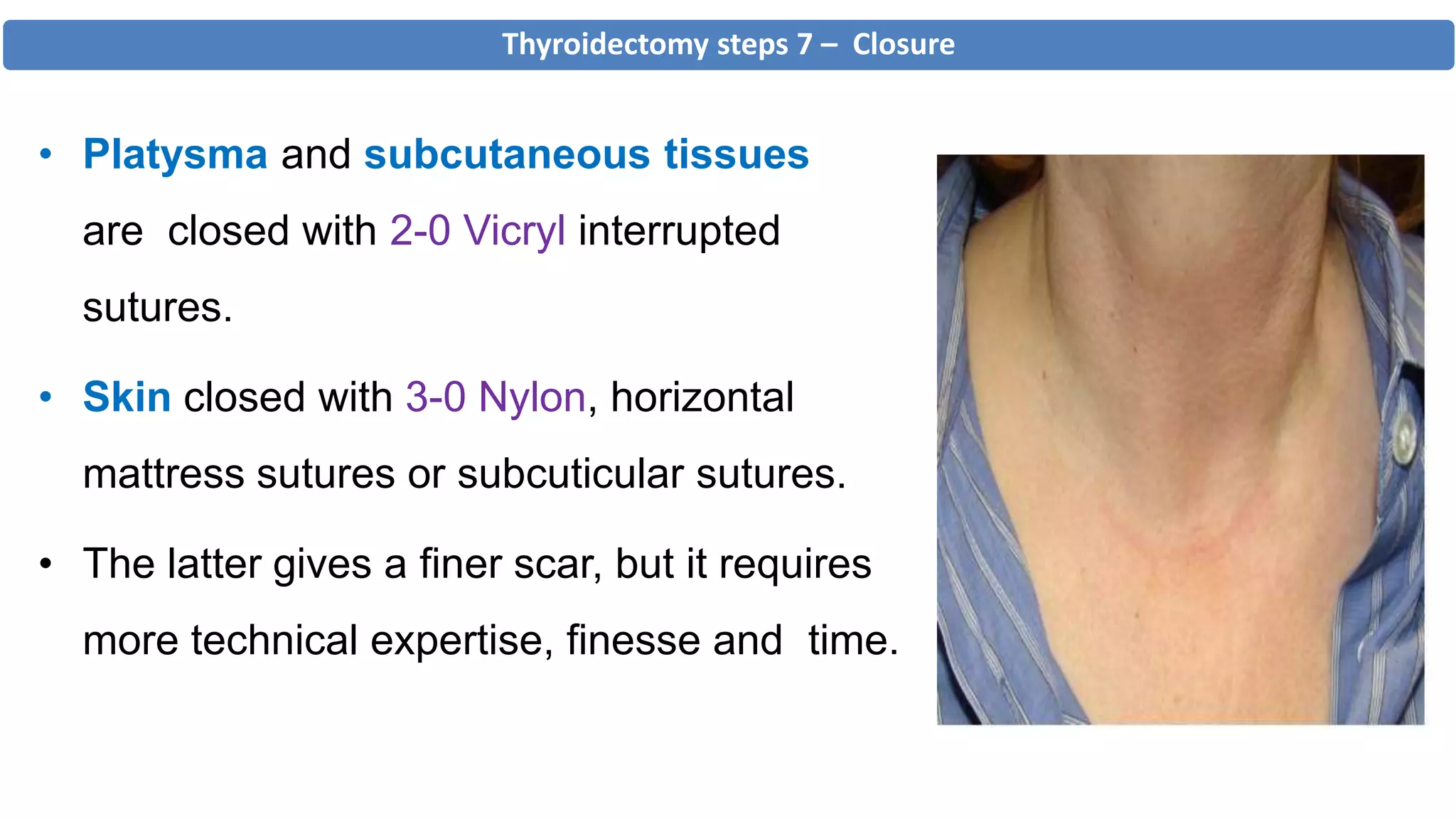 Thyroidectomy | PPTX