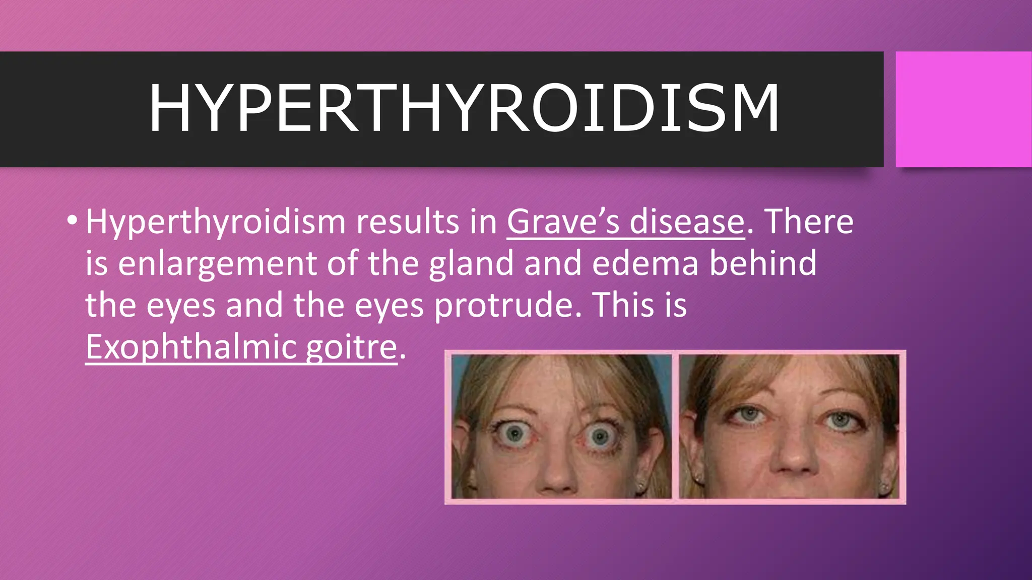 thyroidgland-161025185554.pdf