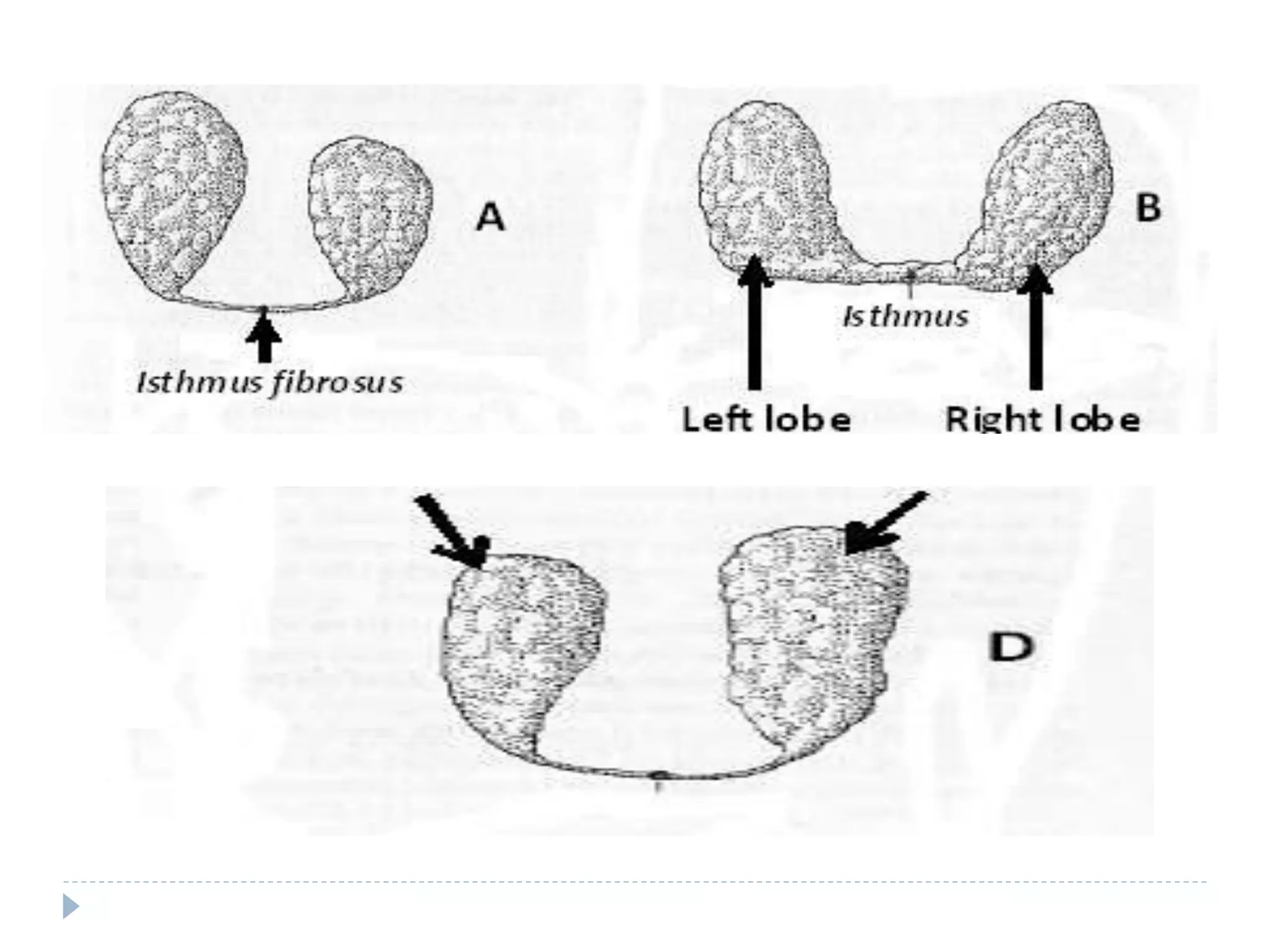 Thyroid Gland Ppt