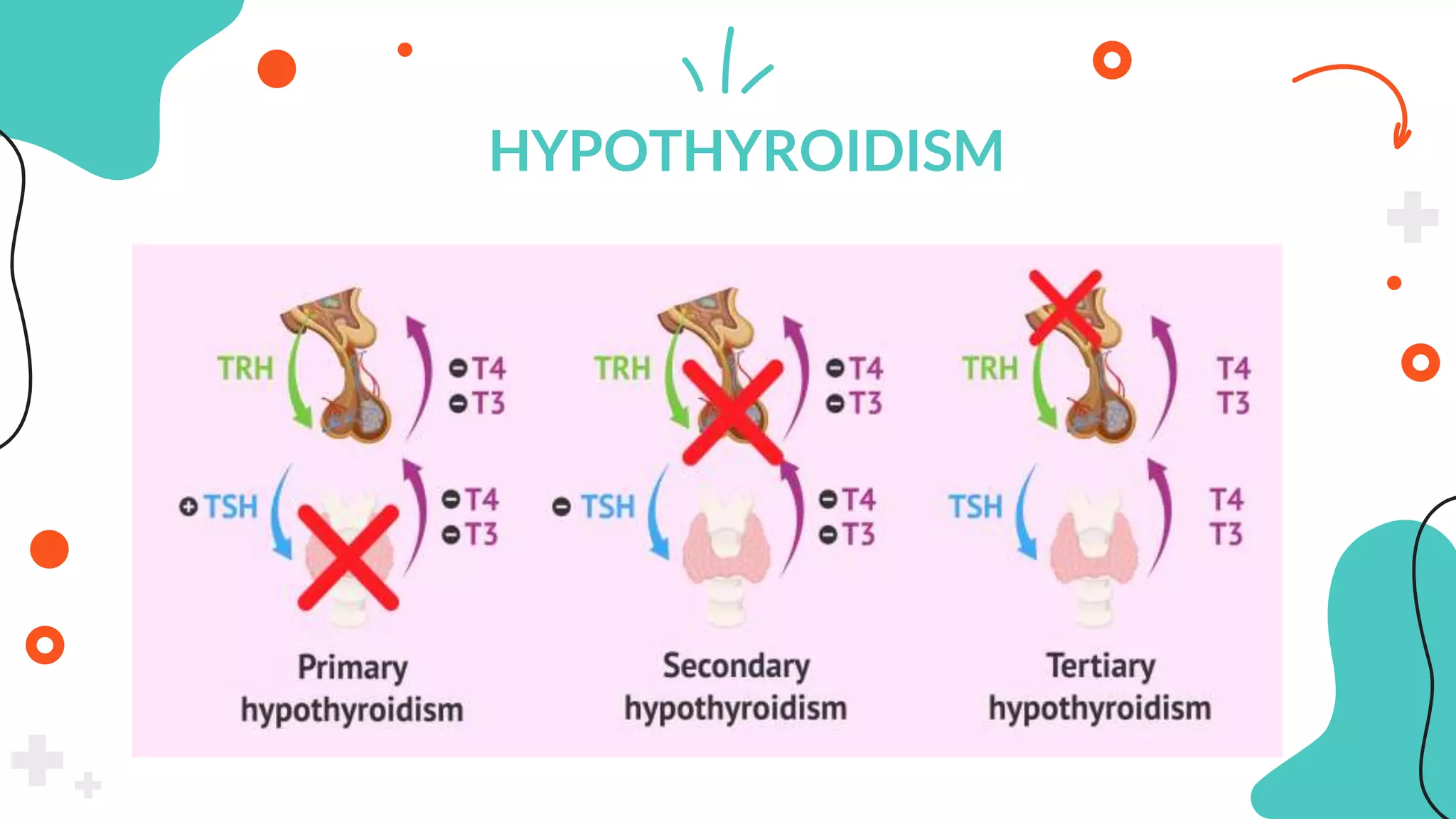 THYROID GLAND.pptx