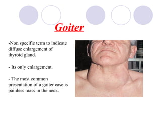 Thyroid gland1 | PPT