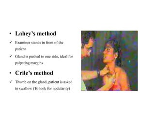 Thyroid gland123 | PPT