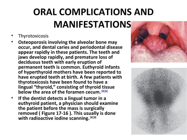 Thyroid gland dysfunction | PPT