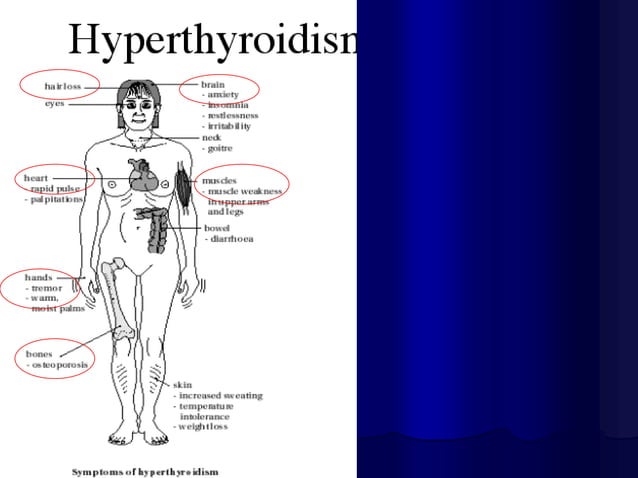Thyroid gland dysfunction2. | PPT