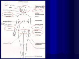 Thyroid gland dysfunction2. | PPT