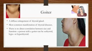 Thyroid gland examination | PPTX